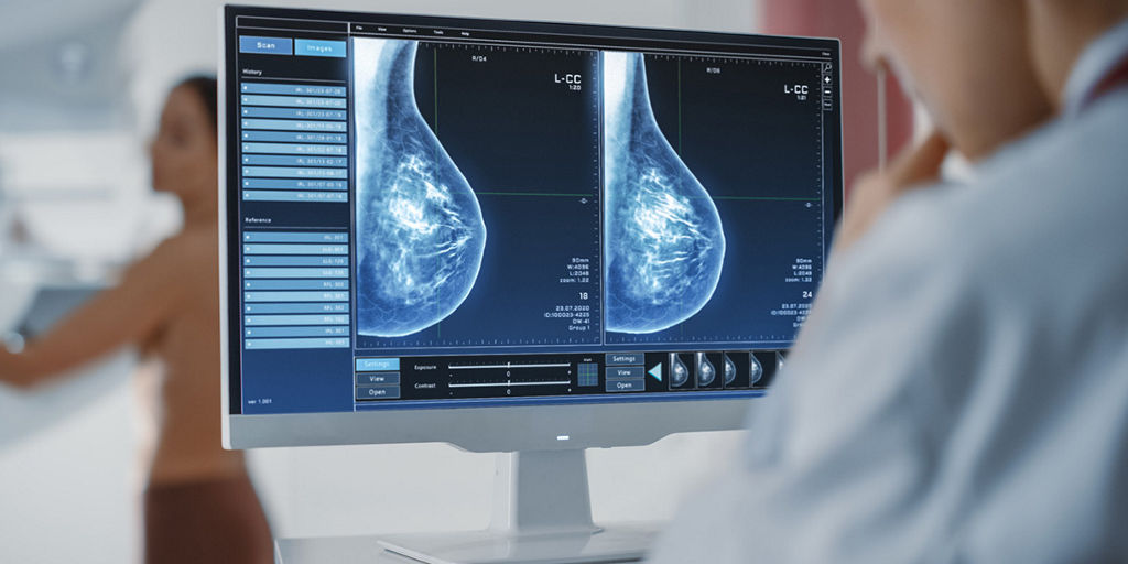 A routine cancer screening may have saved our member's life | Blue Cross NC