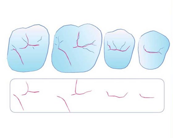 Clinical Case: Essential Lines - A Concept for Functional and Beautiful ...