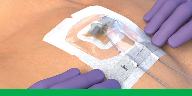 3M™ Tegaderm™ CHG Chlorhexidine Gluconate Gel Pad | Solventum